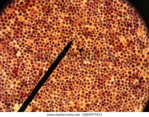 Yeast Budding Yeast Cryptococcus Neoformans Staining Stock Photo (Edit ...