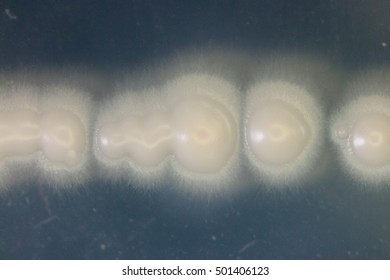33 imágenes de Blastospore - Imágenes, fotos y vectores de stock ...