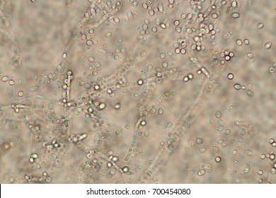 Yeast Under Microscope Stock Photo 700454080 | Shutterstock