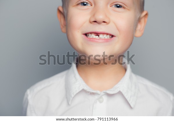 Young Boy Smiling Missing Tooth Stock Photo 791113966 | Shutterstock
