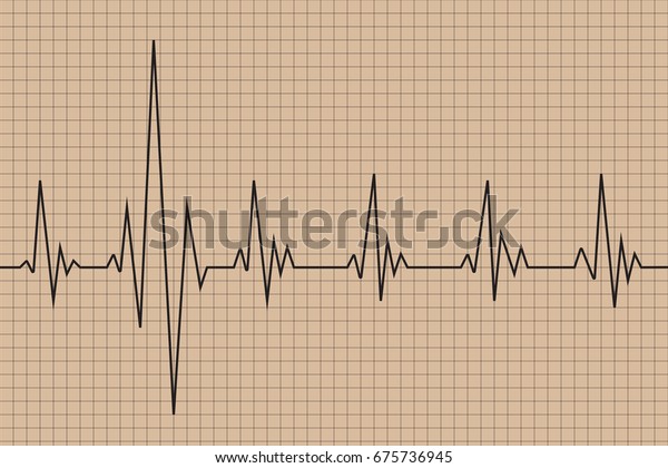 Abnormal Cardiogram Grid On Brown Background Stock Vector (Royalty Free ...