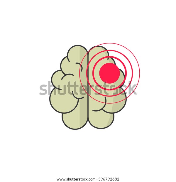 Abstract Human Brain Injury Stroke Cartoon: เวกเตอร์สต็อก (ปลอดค่า ...