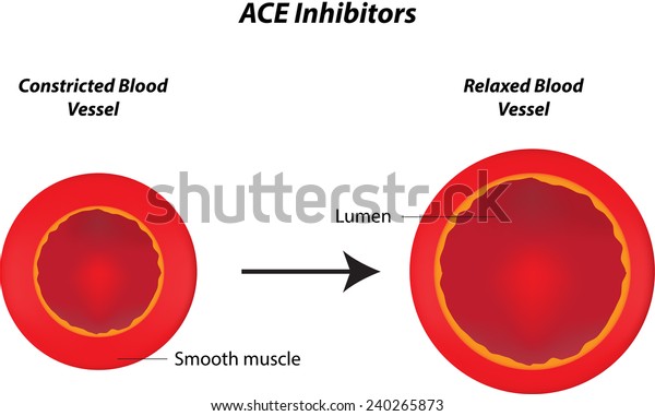 Ace Inhibitors Stock Vector (Royalty Free) 240265873 | Shutterstock
