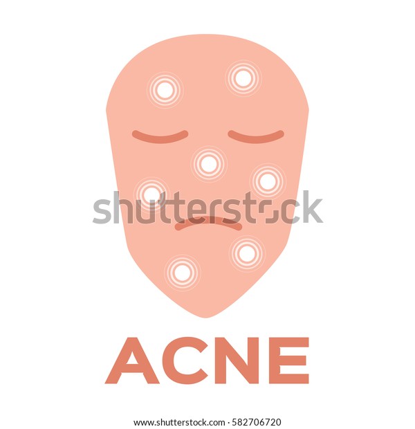 Acne Icon Vector Stock Vector Royalty Free 582706720