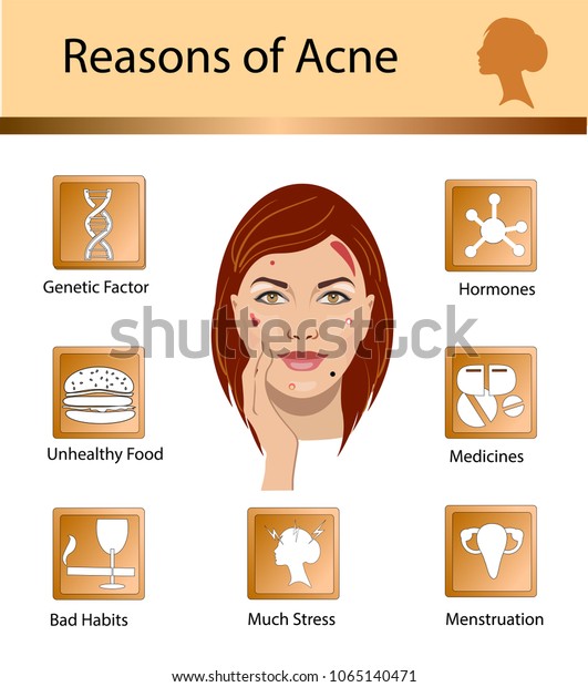 Acne Reasons Skin Problems Diseases Beauty Stock Vector (Royalty Free ...
