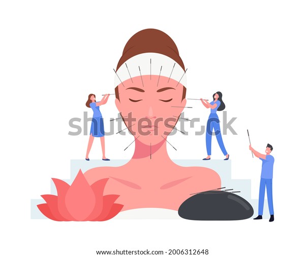 Acupuncture Chinese Therapy Concept Tiny Characters Stock Vector ...