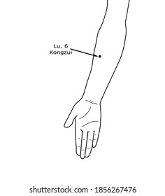244 Acupuncture arm Stock Illustrations, Images & Vectors | Shutterstock