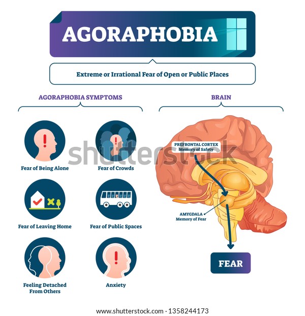 Agoraphobia Vector Illustration Labeled Anatomical Fear: เวกเตอร์สต็อก ...