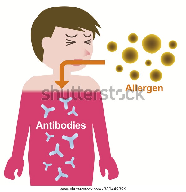 Allergen Antibodies Mechanism Developing Allergy Vector Stock Vector ...