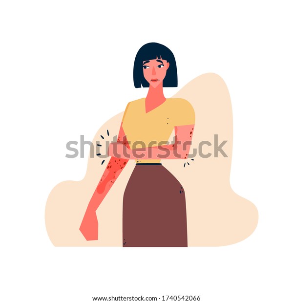 Allergic Reaction Cartoon Vector Illustration Girl 库存矢量图（免版税）1740542066 ...