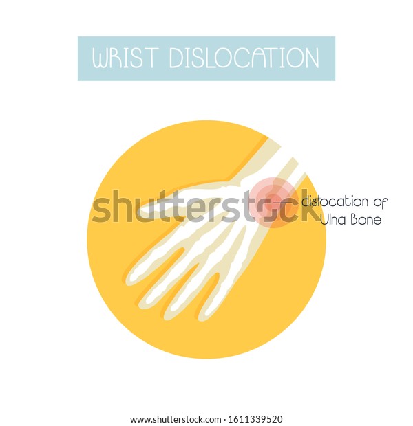 Anatomical Vector Illustration Flat Style Wrist Stock Vector (Royalty ...