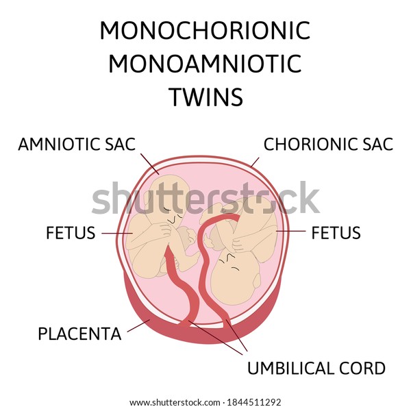 Anatomy Abdomen Twins Infographic Elements Flat Stock Vector (Royalty ...