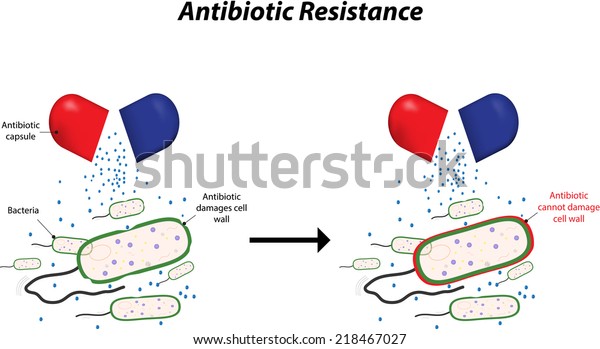 Antibiotic Resistance: เวกเตอร์สต็อก (ปลอดค่าลิขสิทธิ์) 218467027 ...