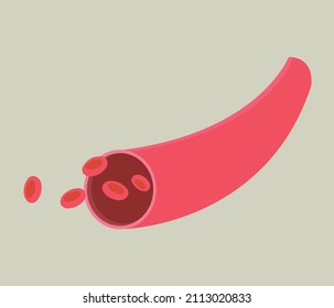 Artery Vector Illustration Isolated On Soft Stock Vector (Royalty Free ...
