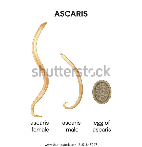 Ascaris Illustration Parasitic Nematode Type Parasitic: เวกเตอร์สต็อก ...