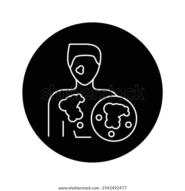 Atopic Dermatitis Black Glyph Icon Sign Stock Vector (Royalty Free ...