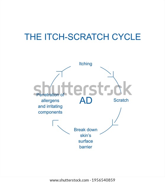 Atopic Dermatitis Itchscratch Cycle Conditions Eczemaprone Stock Vector ...