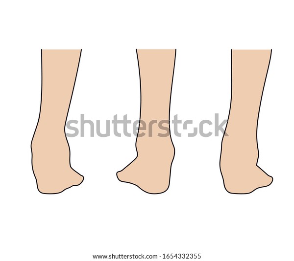 Back View Human Ankle Foot Stock Vector (Royalty Free) 1654332355 ...