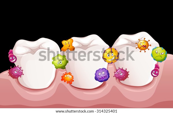 Bacteria Human Teeth Illustration Stock Vector (Royalty Free) 314325401