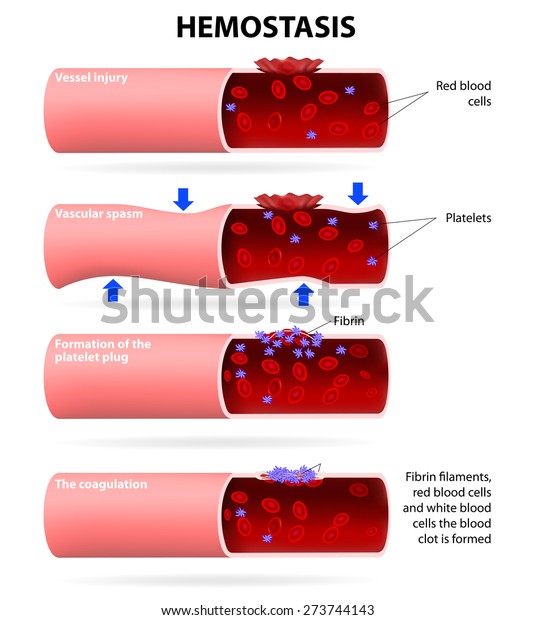 Basic Steps Hemostasis Stock Vector (Royalty Free) 273744143