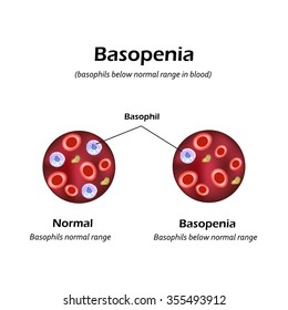 Basophils Above Normal Range Blood Basophilia 库存插图 362810654 | Shutterstock