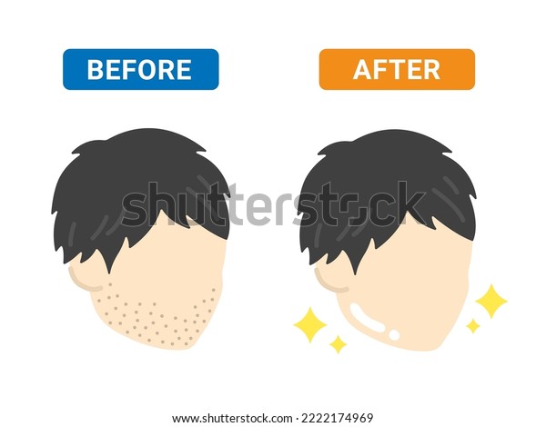 Before After Illustration Man Who Has Stock Vector (Royalty Free ...