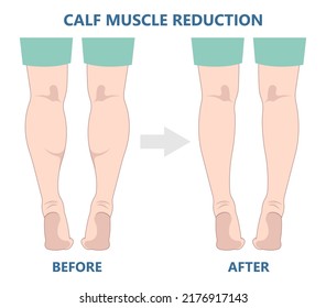 185,375 Muscled legs Images, Stock Photos & Vectors | Shutterstock