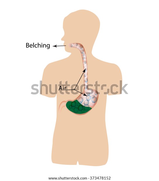 Belching Air Stomach Structure Esophagus Stomach Stock Vector (Royalty ...