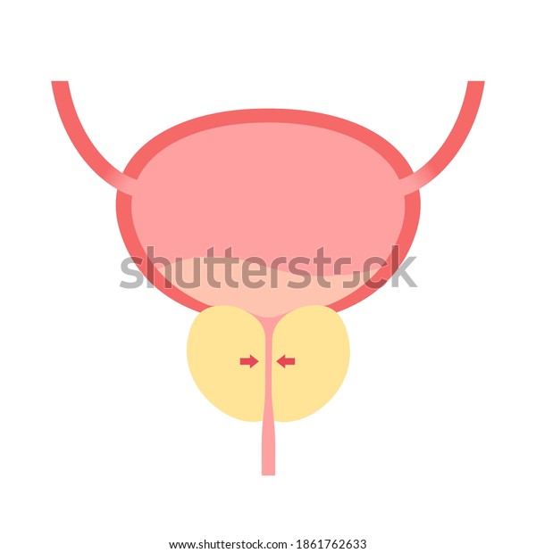 Benign Prostatic Hyperplasia Logo Clinic Pain Stock Vector (Royalty ...