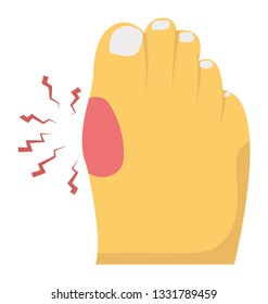 86 Big toe bleeding Images, Stock Photos & Vectors | Shutterstock
