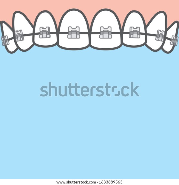 Blank Banner Upper Clear Braces Teeth Stock Vector (Royalty Free ...