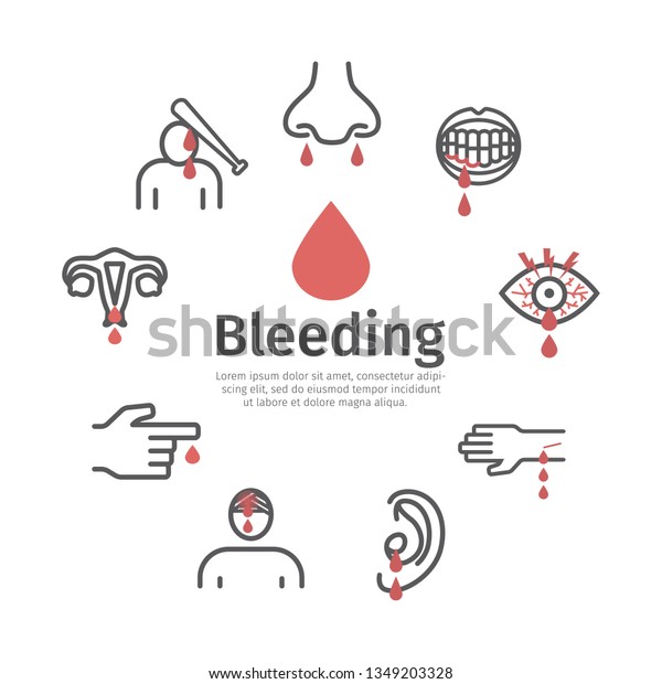 Bleeding Banner Infographic Vector Signs Web 库存矢量图（免版税）1349203328