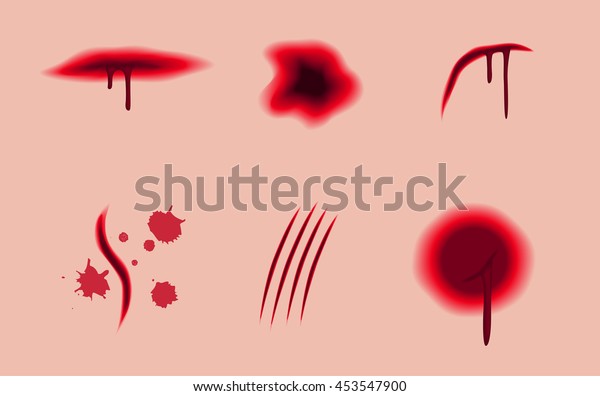 Bleeding Wound On Skin Set Cuts Stock Vector (Royalty Free) 453547900