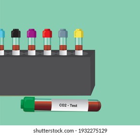 Blood Sample Co2 Carbon Dioxide Test Stock Vector (Royalty Free ...