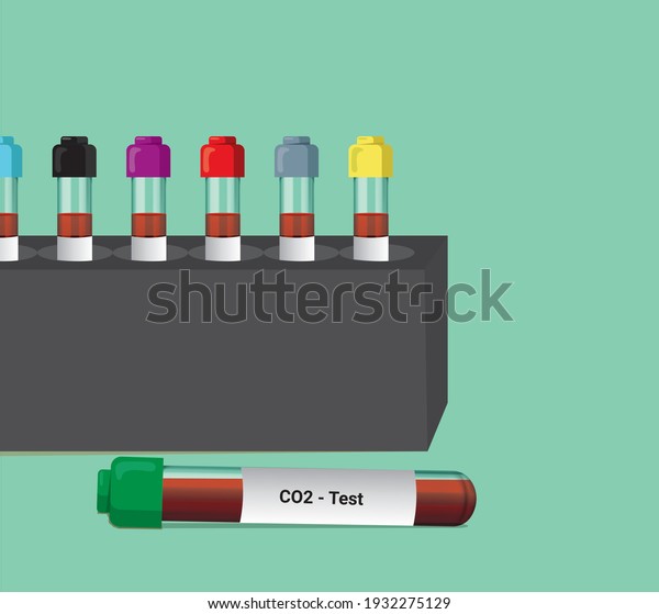 Blood Sample Co2 Carbon Dioxide Test Stock Vector (Royalty Free ...