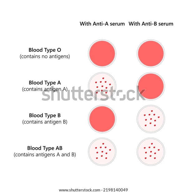 Blood Typing Abo Blood Types Stock Vector (Royalty Free) 2198140049 ...