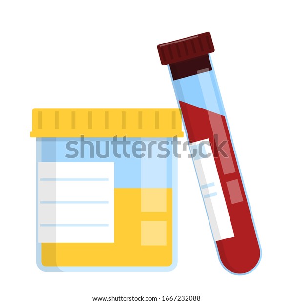 Blood Urine Samples Vector Isolated Medical Stock Vector (Royalty Free ...