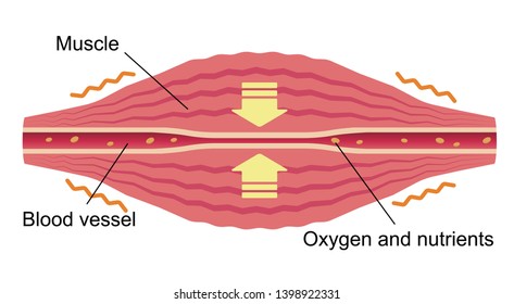 Muscle Becomes Tense Flat Illustration Muscle Stock Vector (Royalty ...