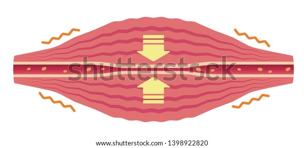 Blood Vessel Compressed No Text Flat Stock Vector (Royalty Free ...