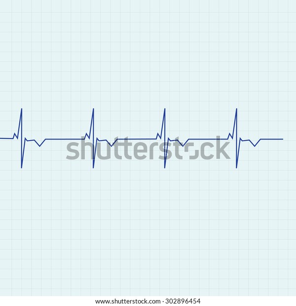 Blaue Ekg-Linie auf Graph-Papierhintergrund, Herzmonitor ...