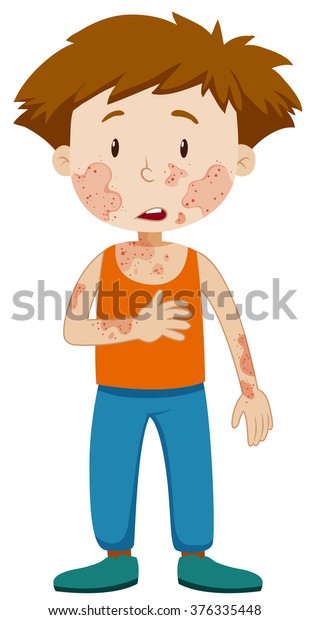 Boy Infectious Disease Illustration Stock Vector (Royalty Free ...