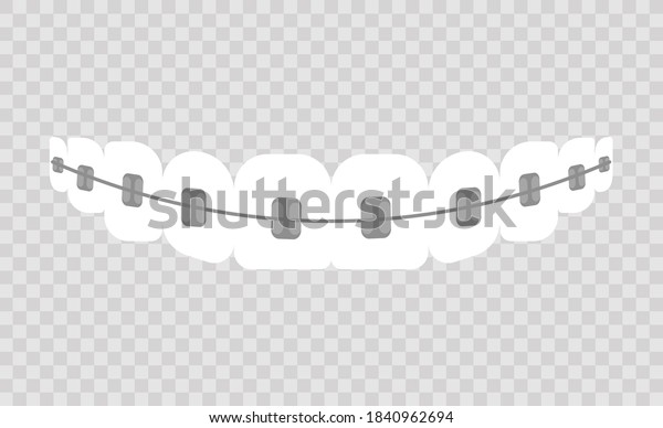 Braces Transparent Icon Braces Symbol Design: vetor stock (livre de ...