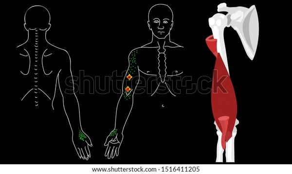 Brachialis Muscle Trigger Points Arm Stock Vector (Royalty Free ...