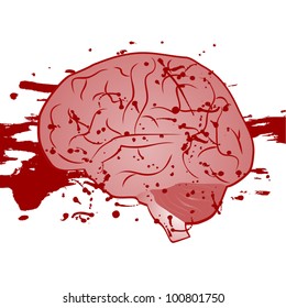 2,387 Brain bleeding Images, Stock Photos & Vectors | Shutterstock