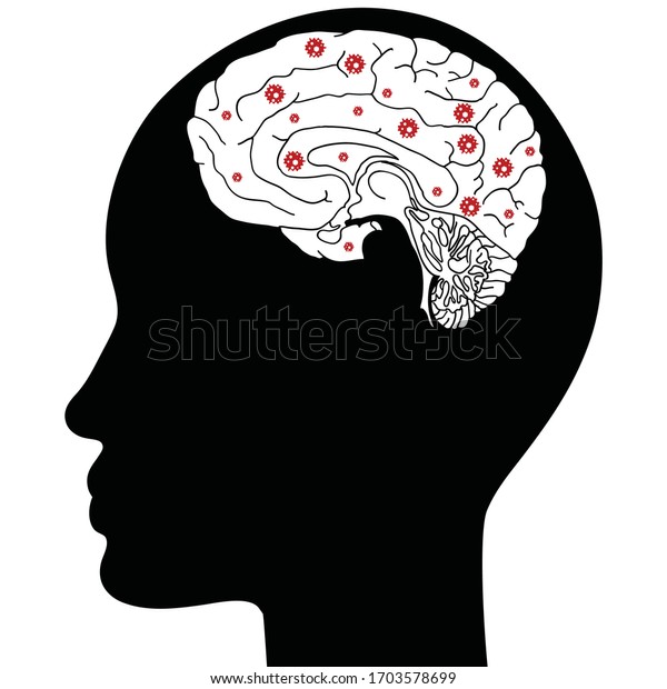 Brain Infected By Coronaviruses Vector Illustration Stock Vector ...