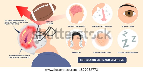 Brain Injury Mild Post Head Bleed Stock Vector (Royalty Free) 1879052773
