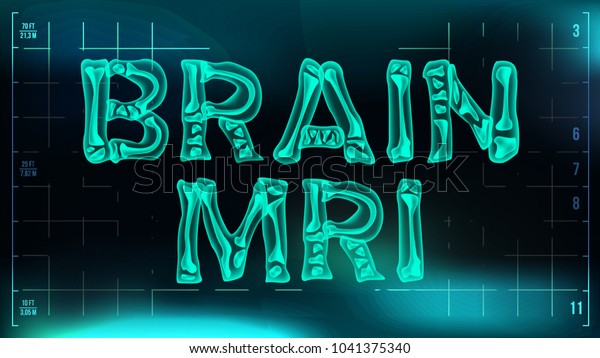Brain Mri Banner Vector Medical Background Stock Vector (Royalty Free ...