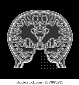 Brain Transverse Section Scan Illustration Eps Stock Vector (Royalty ...