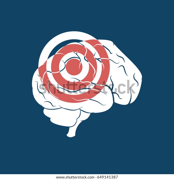 Brain Tumor Vector Illustration Isolated On Stock Vector (Royalty Free ...