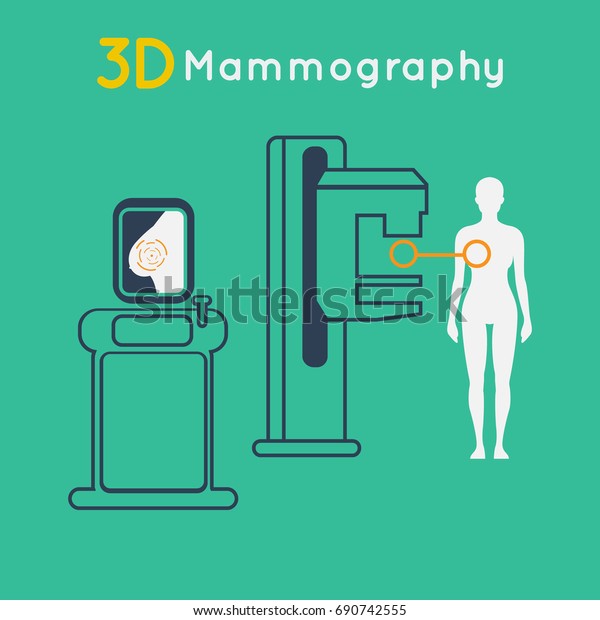 Breast Cancer 3d Mammography Vector Illustration Stock Vector (Royalty ...